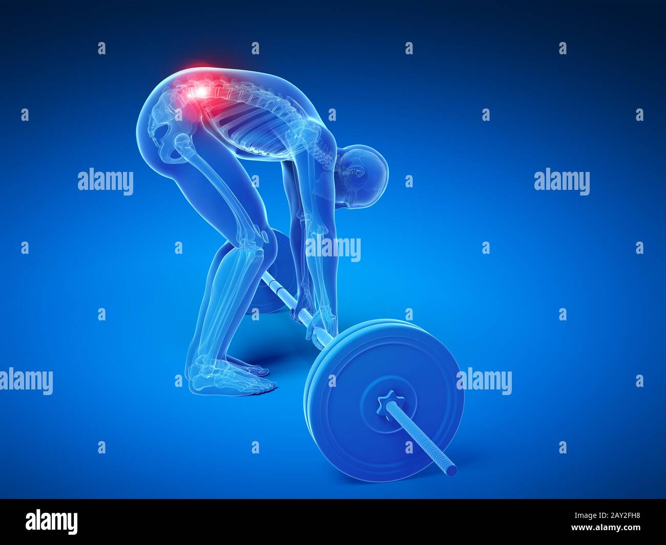 3d rendered medical illustration - wrong lifting posture Stock Photo ...