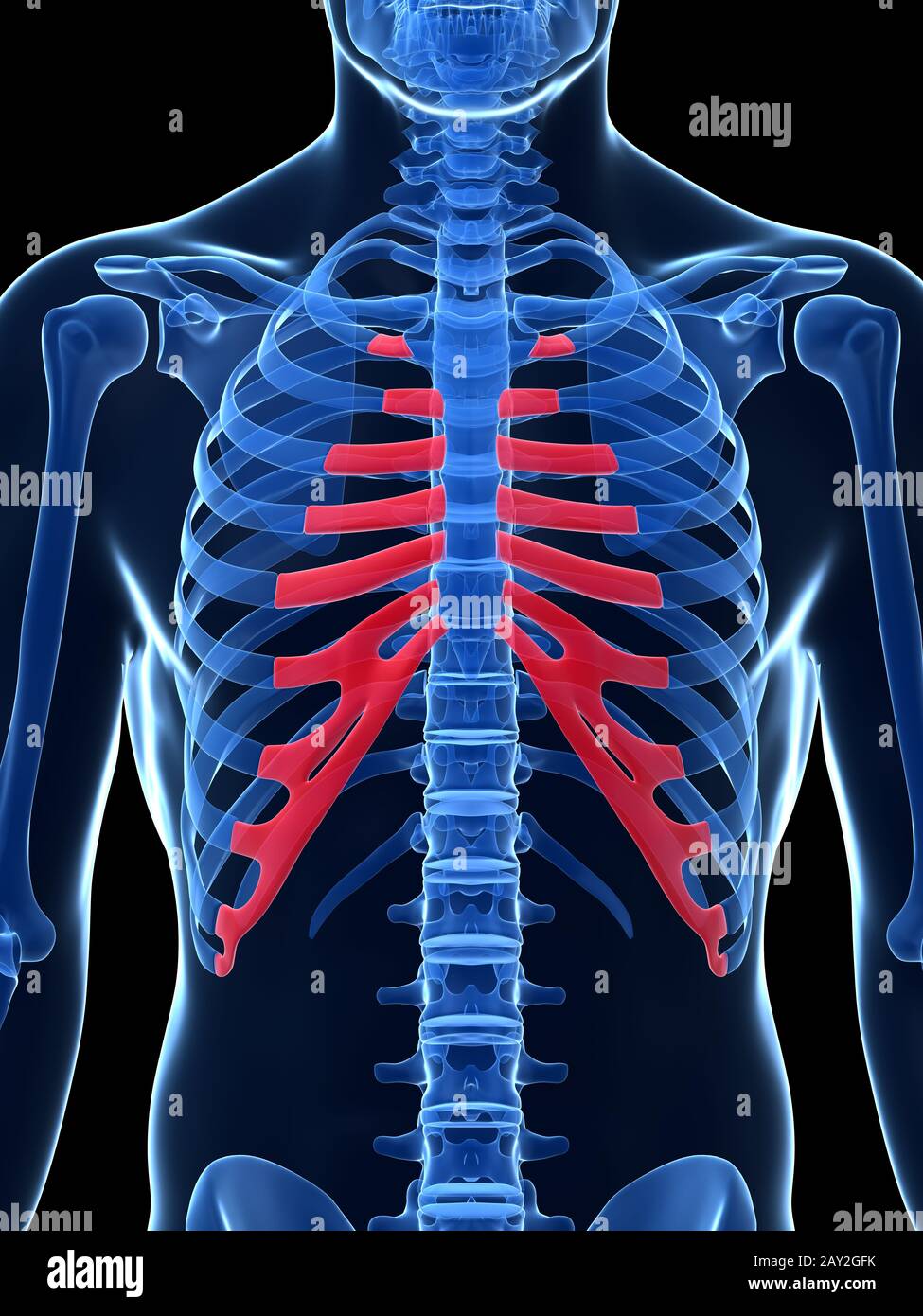 Costochondral Junction
