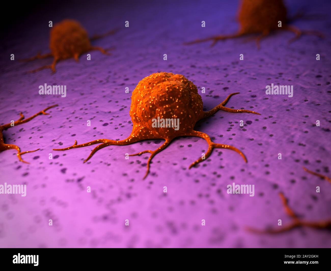 Cancer cell electron microscope hi-res stock photography and images - Alamy