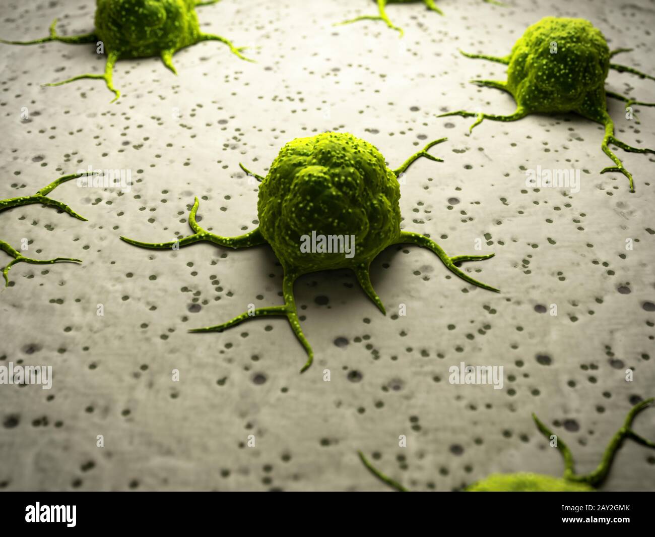 Cancer cell electron microscope hi-res stock photography and images - Alamy