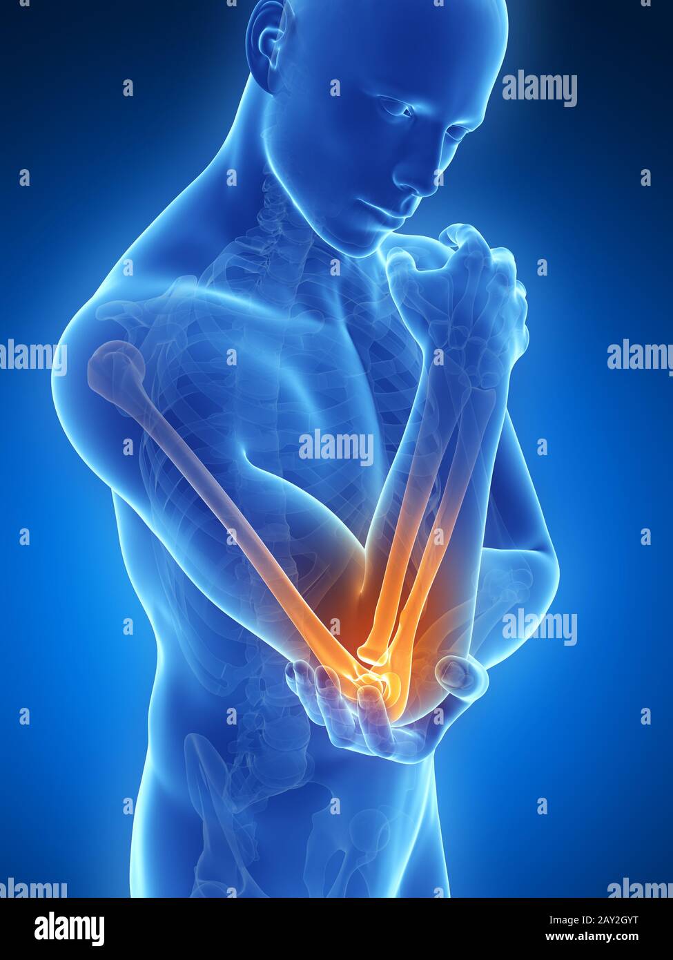 3d rendered illustration of pain in the elbow Stock Photo - Alamy