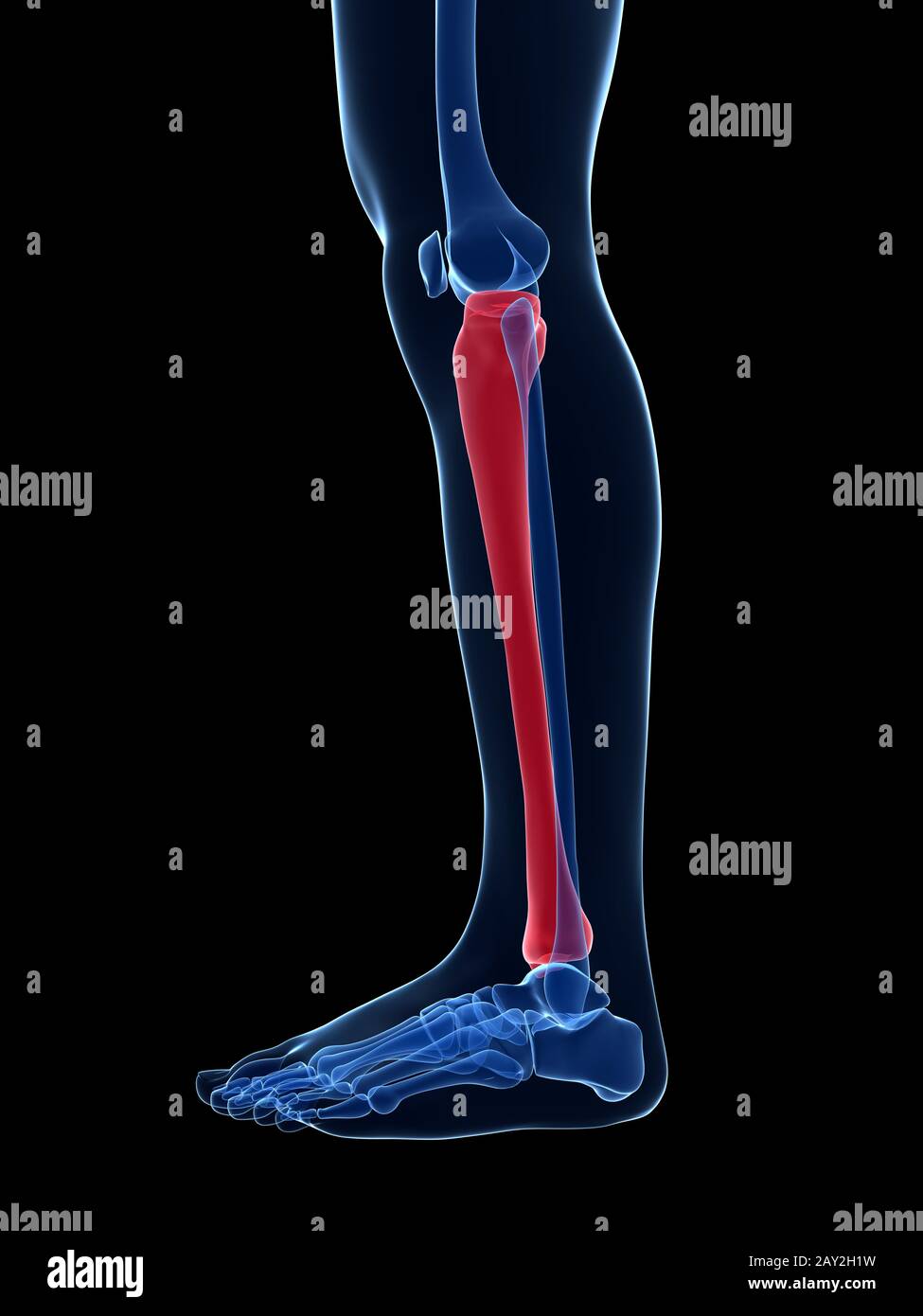 Tibia x ray hi-res stock photography and images - Alamy