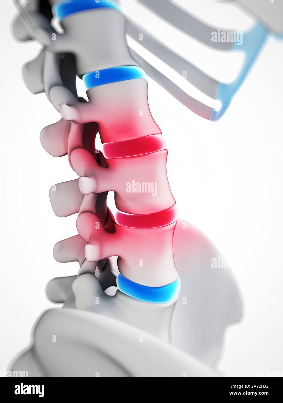 3d rendered illustration - intervertebral disks Stock Photo - Alamy