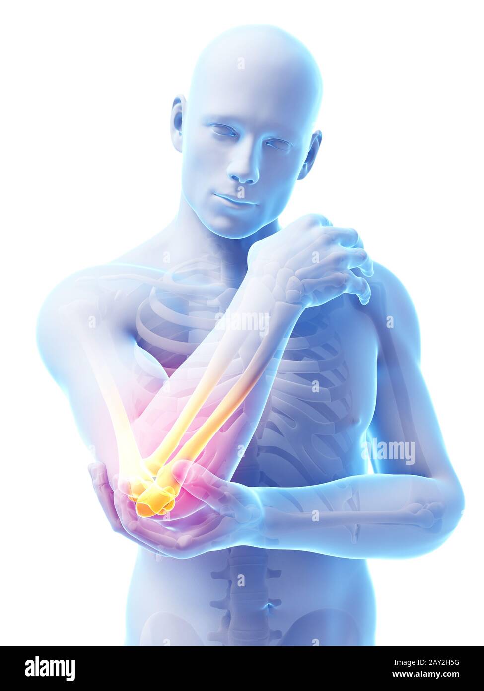 3d rendered illustration of pain in the elbow Stock Photo - Alamy