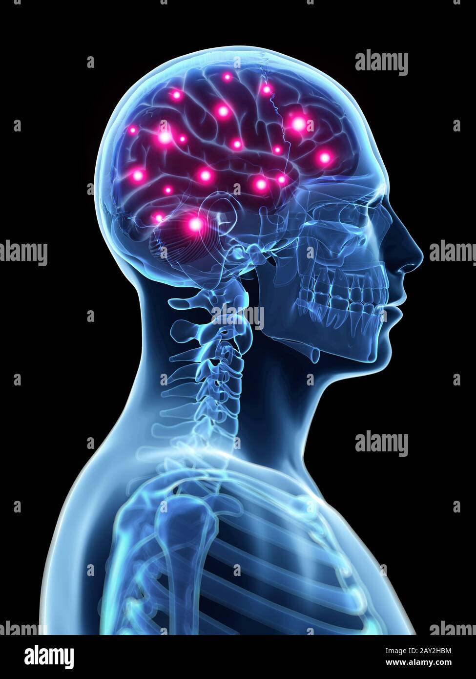 3d rendered illustration - active brain Stock Photo - Alamy