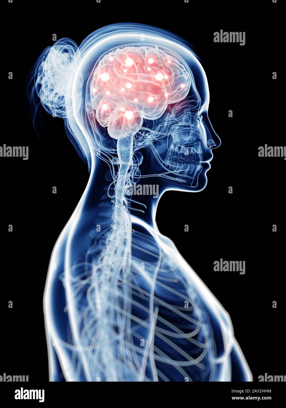 3d rendered illustration of an active brain Stock Photo - Alamy