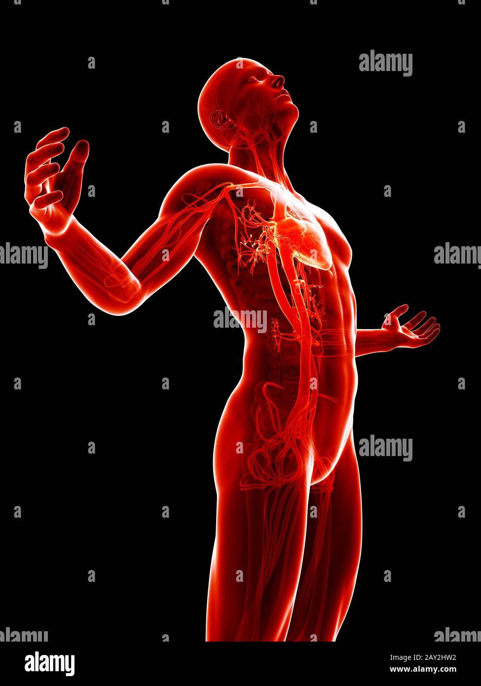 medical illustration - inflamed human body Stock Photo - Alamy