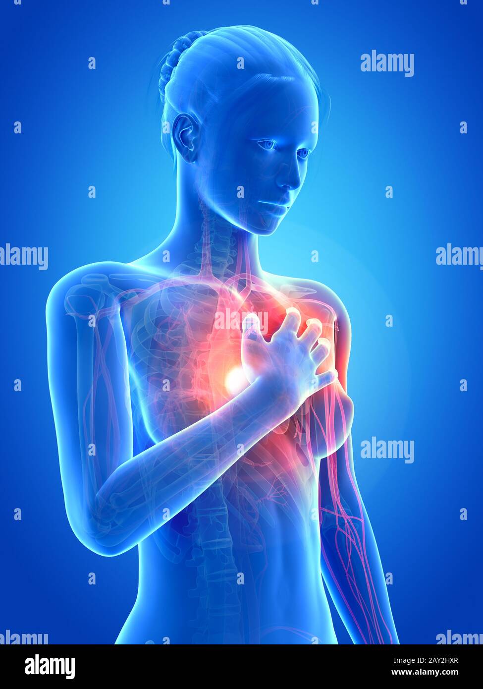 Woman heart attack illustration hi-res stock photography and images - Alamy