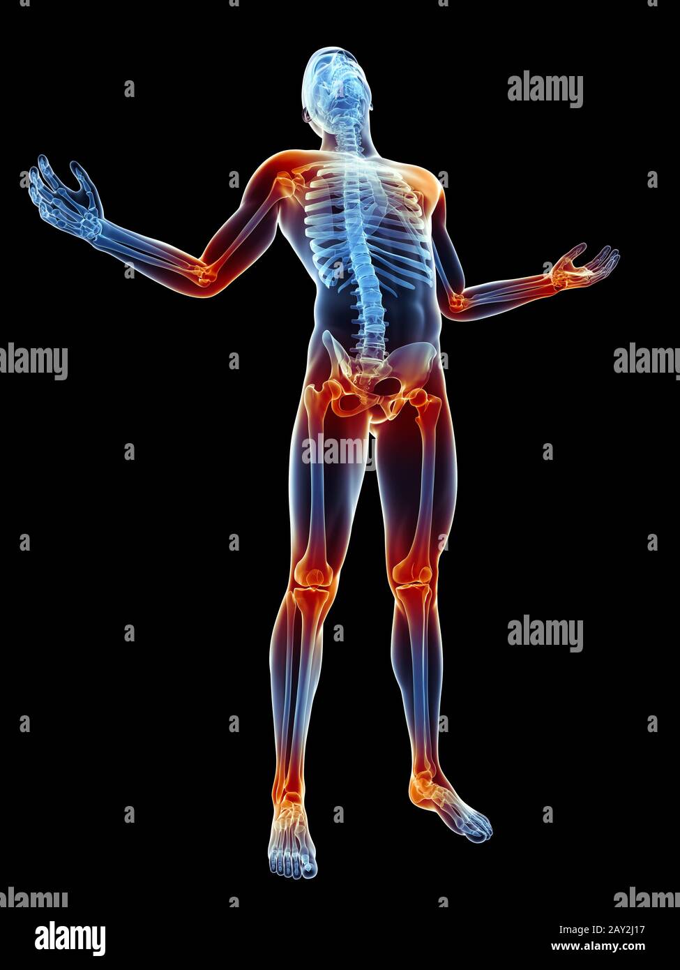 medical illustration showing painful joints Stock Photo - Alamy