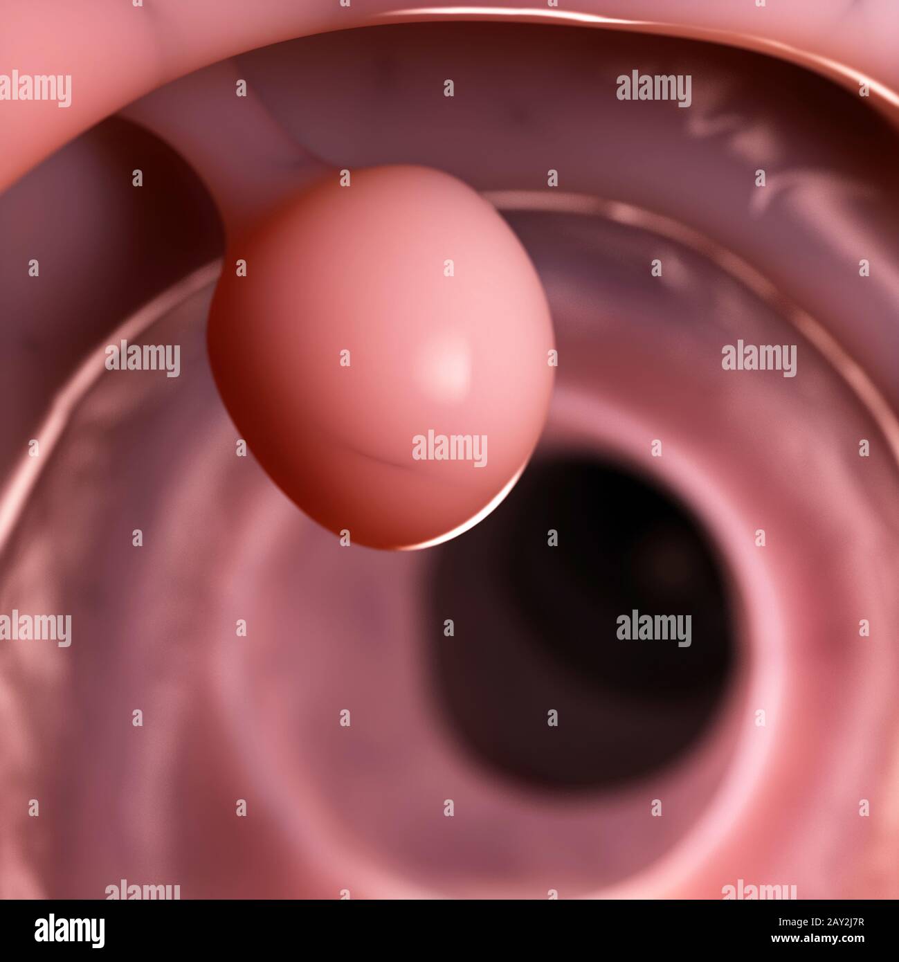 Colorectal cancer cells scan hi-res stock photography and images - Alamy