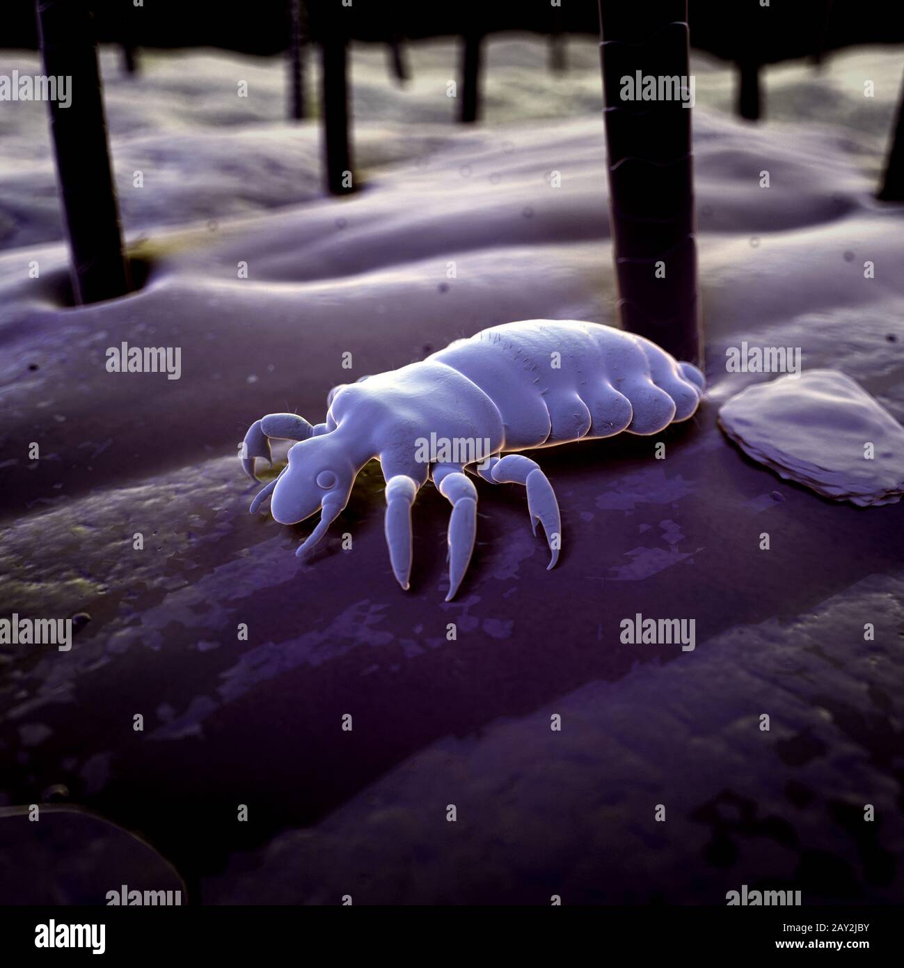 Head louse human hair hi-res stock photography and images - Alamy