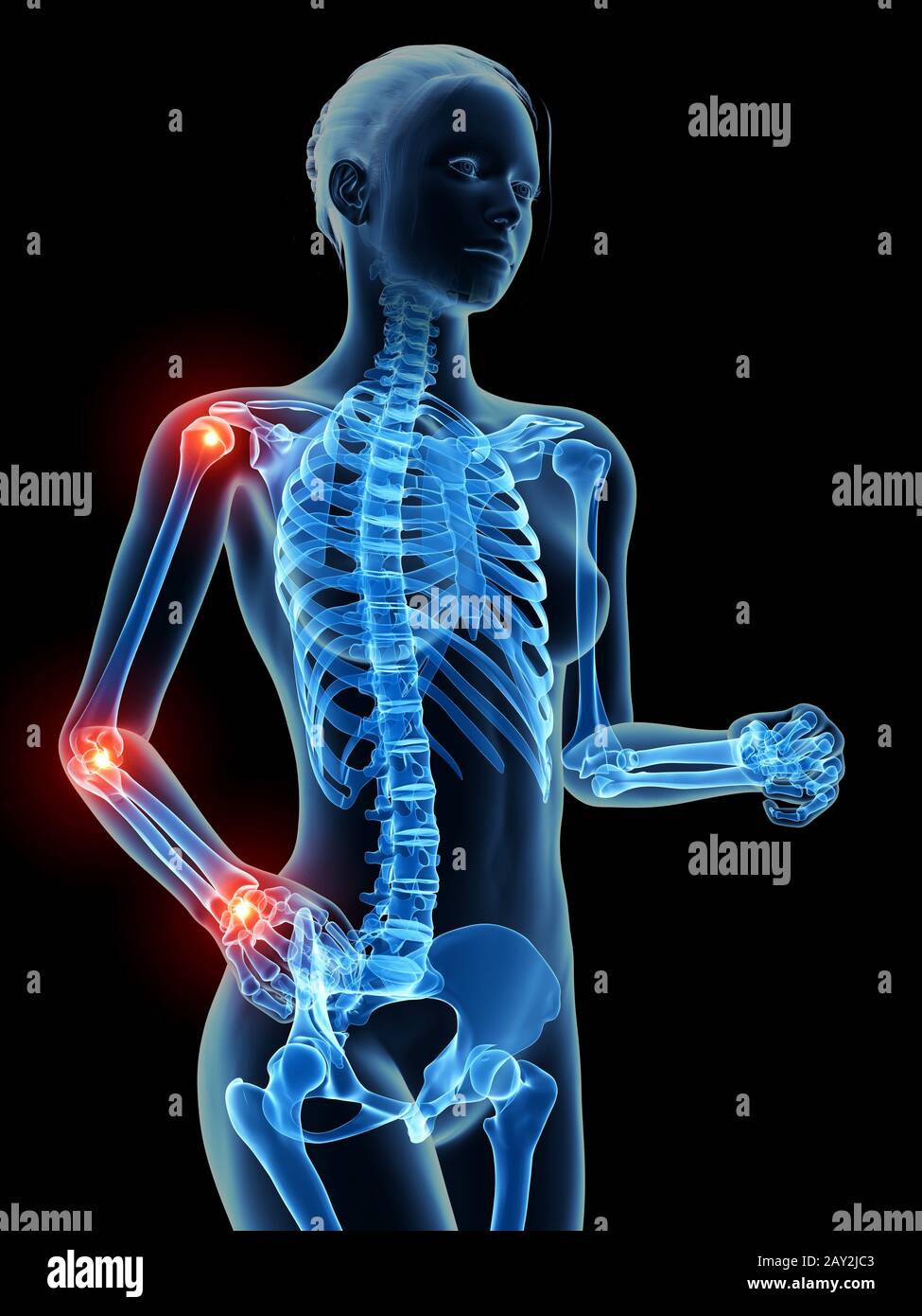 Painful joints hi-res stock photography and images - Alamy