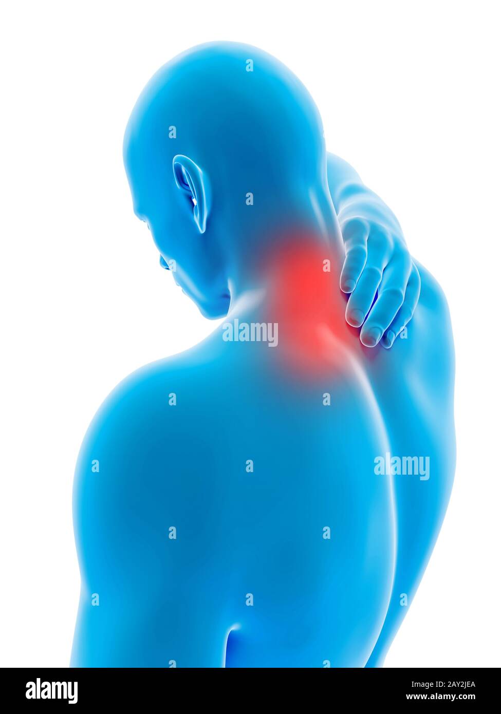 Neck pain illustration hi-res stock photography and images - Alamy