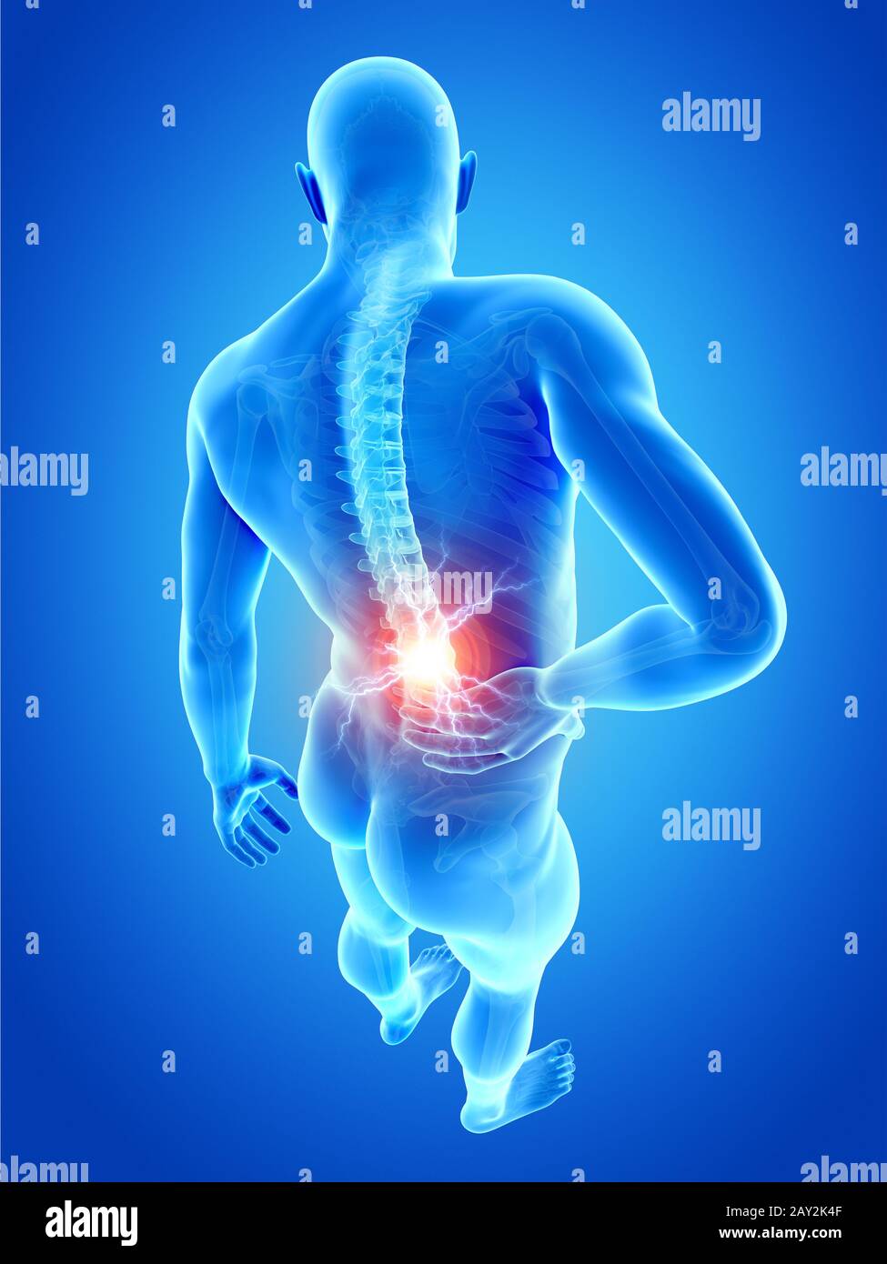 Backache joint hi-res stock photography and images - Alamy
