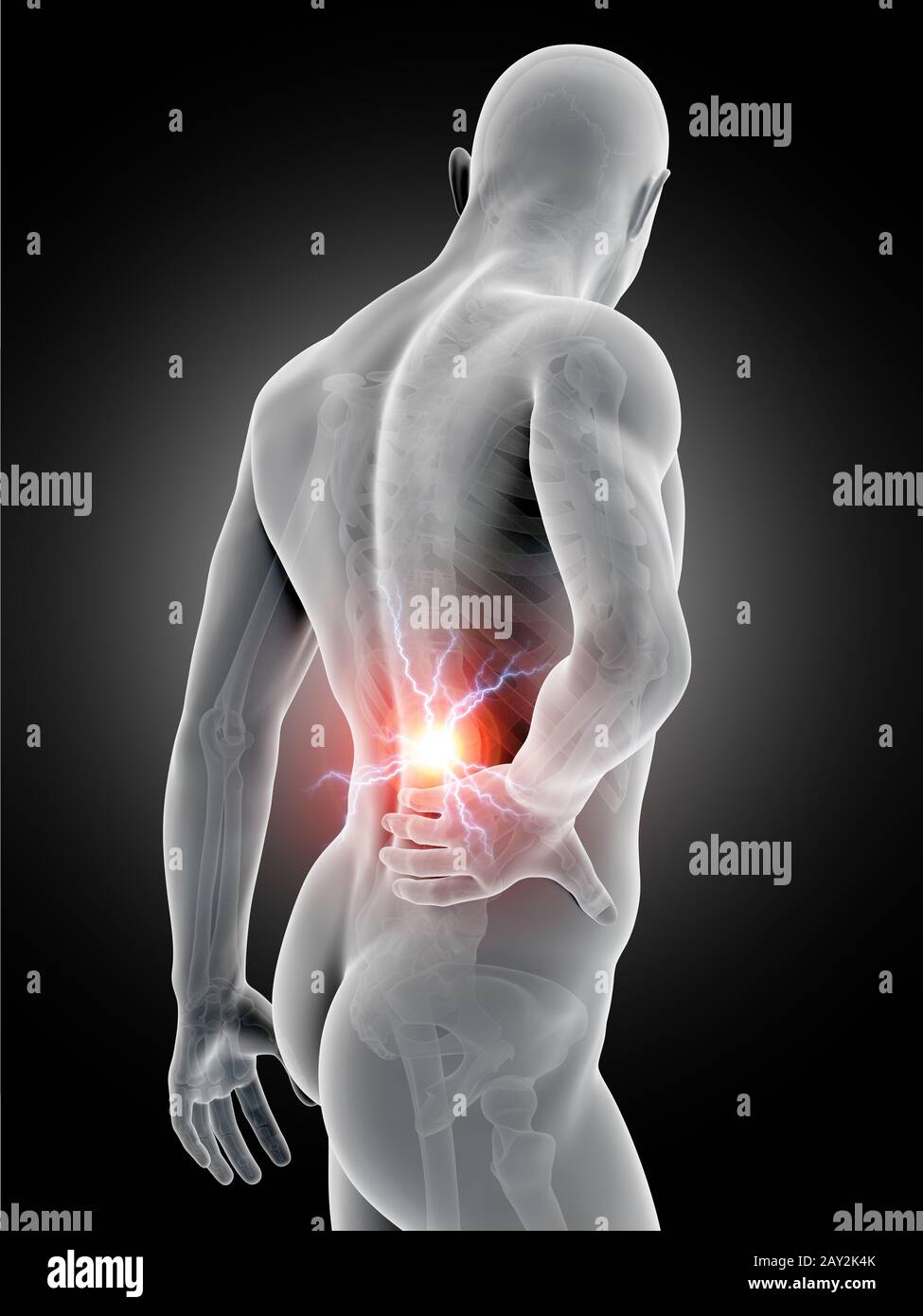 Backache joint hi-res stock photography and images - Alamy