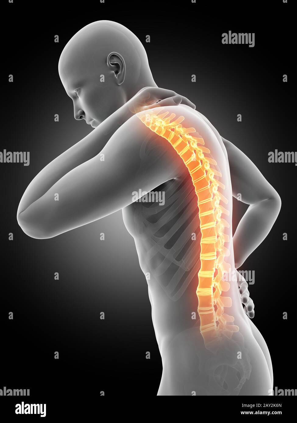 Backache joint hi-res stock photography and images - Alamy