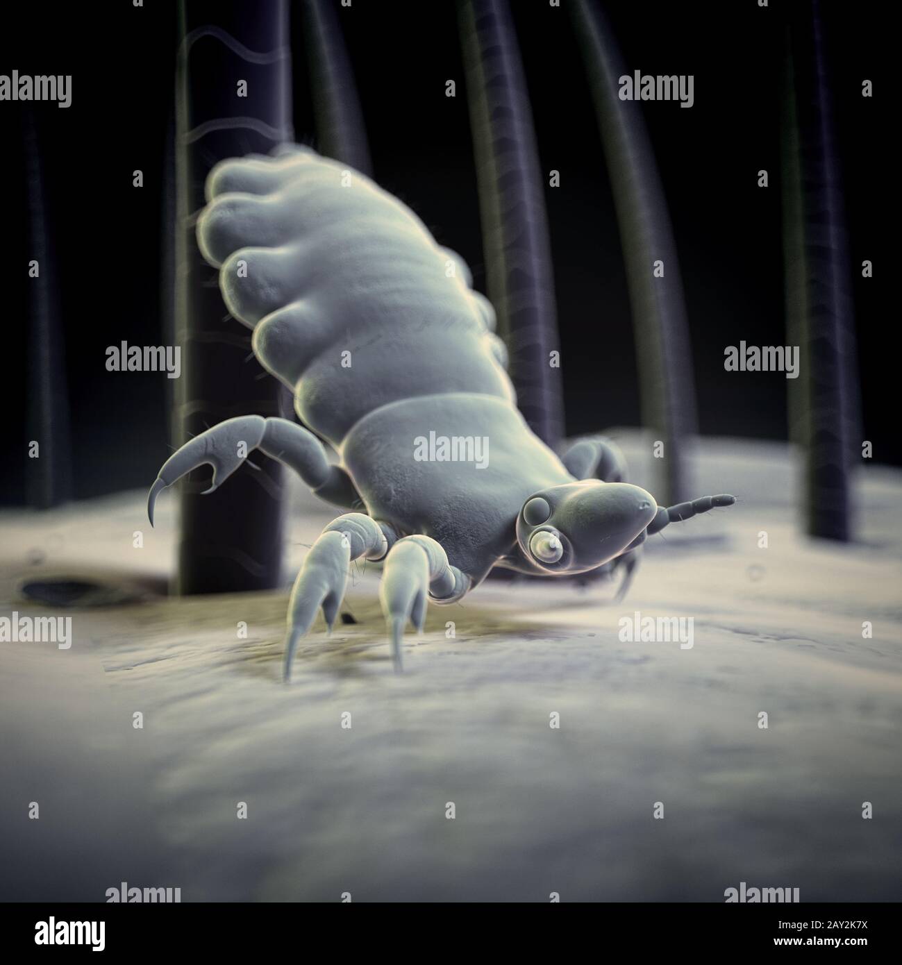 Body louse hi-res stock photography and images - Alamy