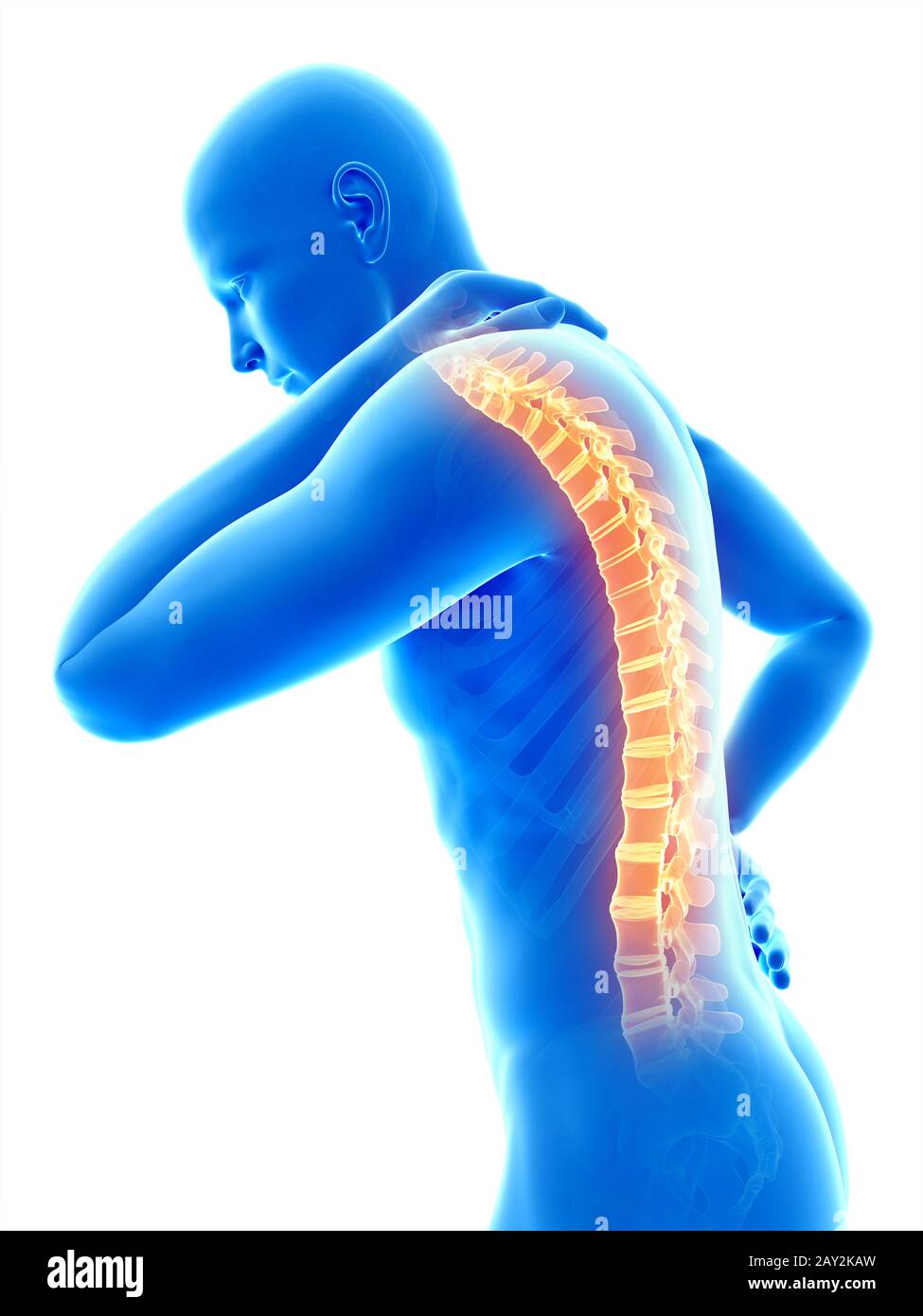 Backache illustration Cut Out Stock Images & Pictures - Alamy