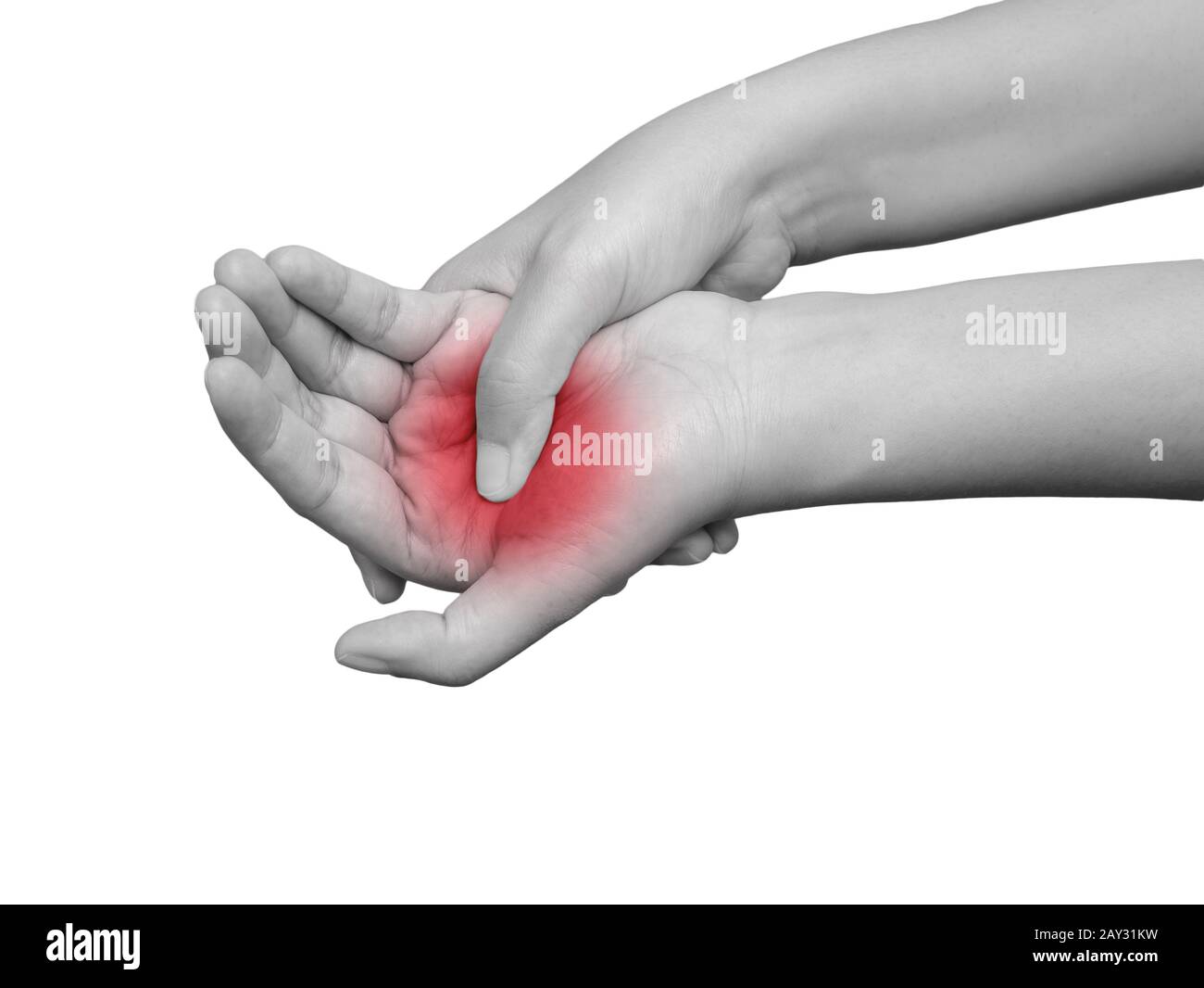 Rheumatoid arthritis hand hi-res stock photography and images - Alamy