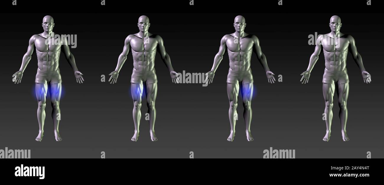 Torn thigh muscle hi-res stock photography and images - Alamy