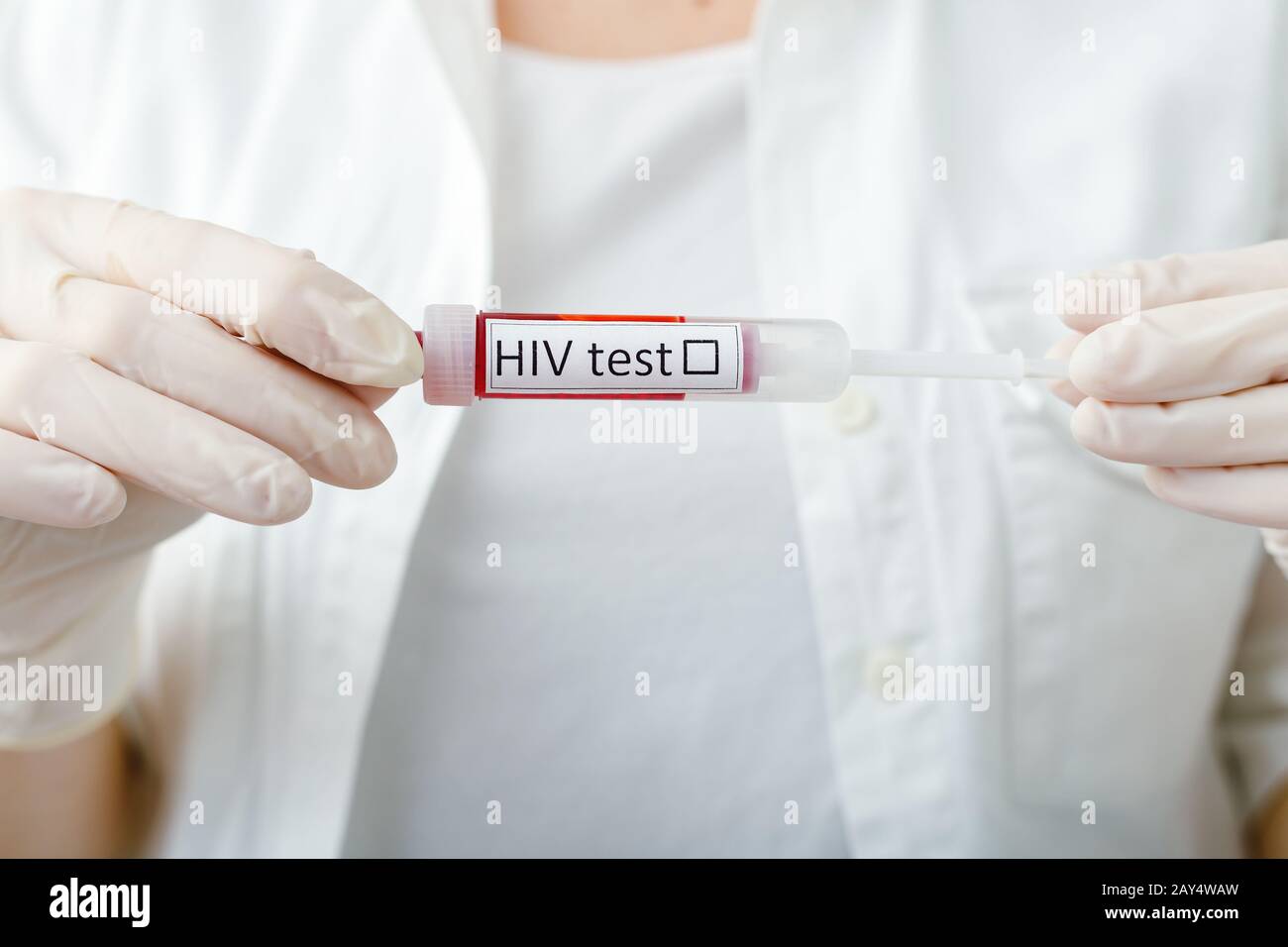 HIV AIDS medical test. HIV test in a doctors hand in glove on a white ...