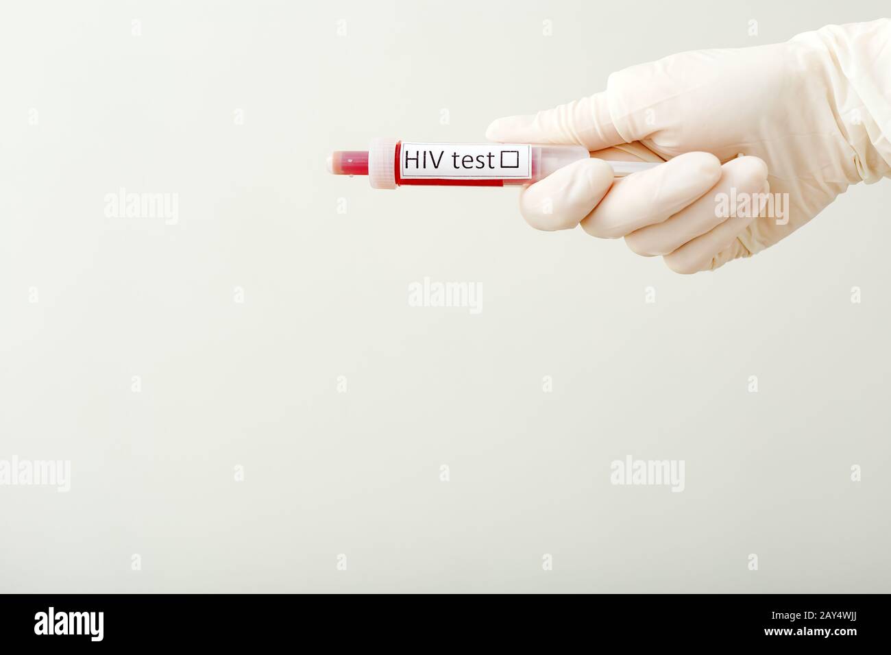HIV AIDS medical test. HIV test in a doctors hand in glove on a white ...