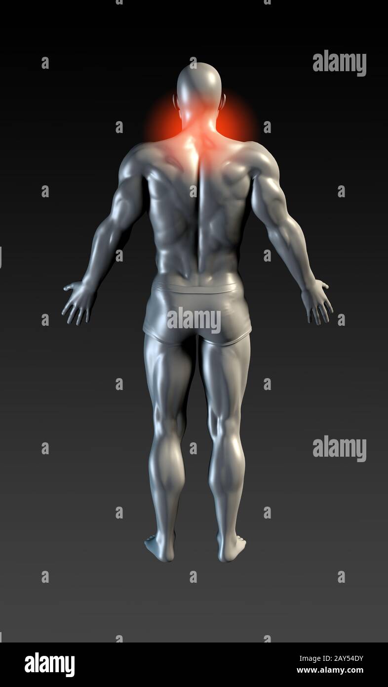 Neck injury hi-res stock photography and images - Alamy