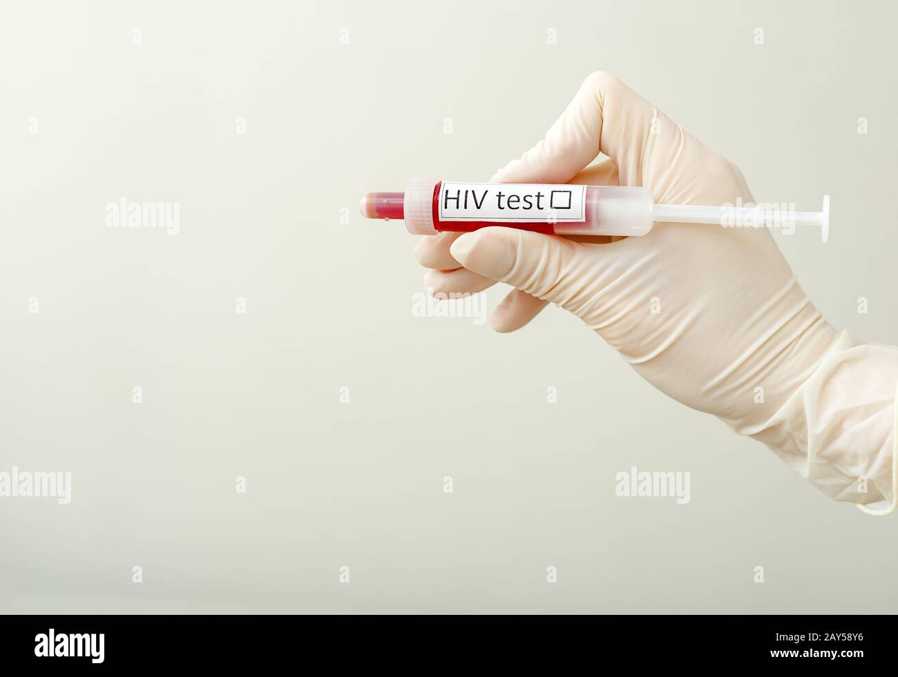 Hiv analysis hi-res stock photography and images - Alamy