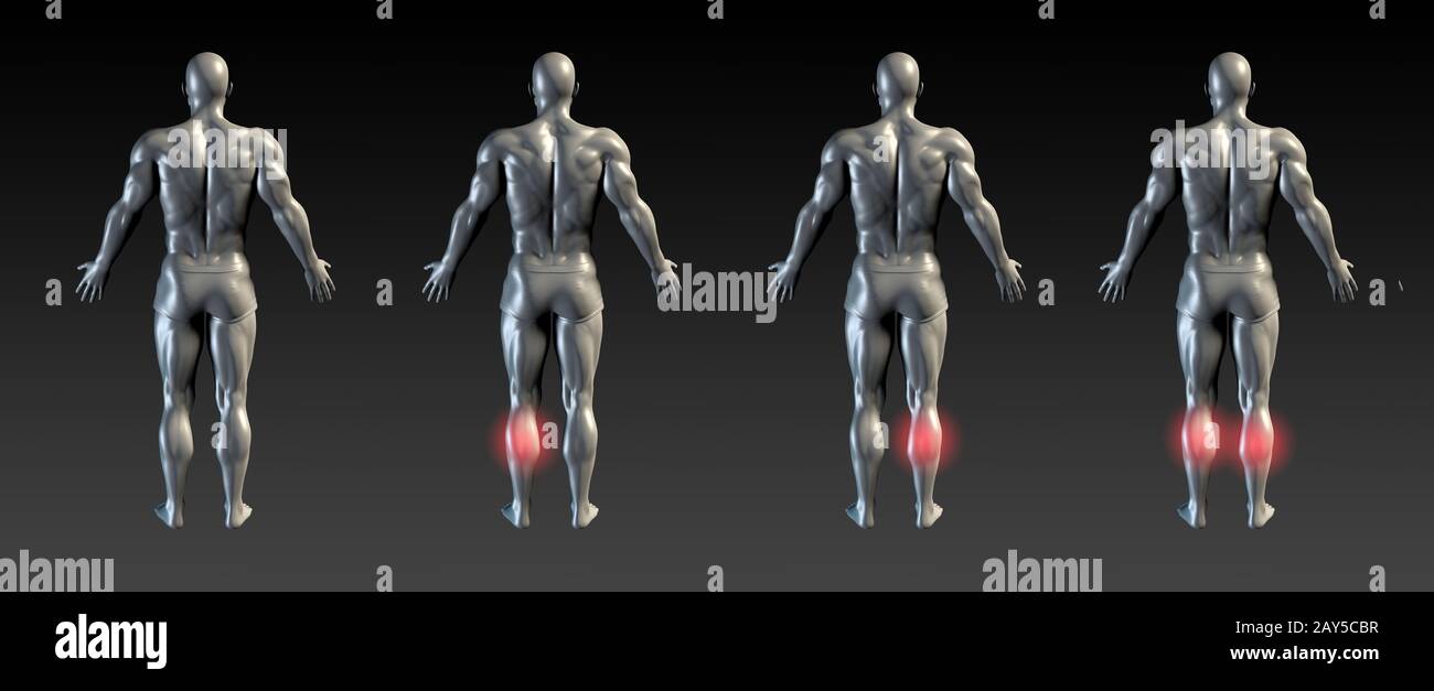 Human calf muscles hi-res stock photography and images - Alamy