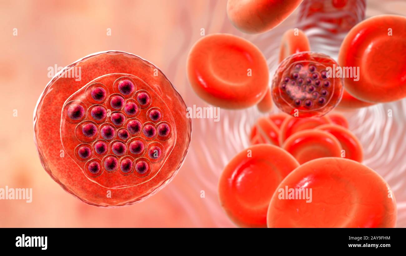 Plasmodium falciparum inside red blood cell, illustration Stock Photo ...