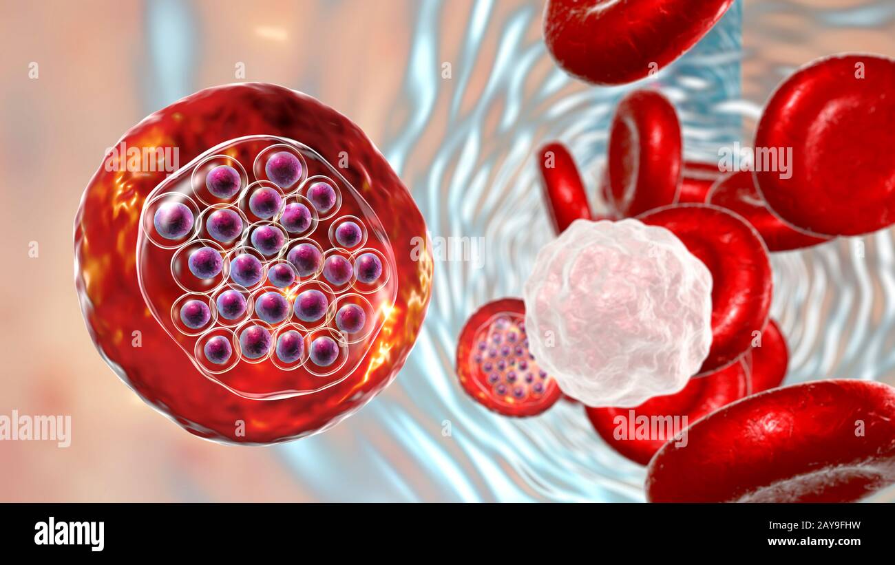 Plasmodium falciparum inside red blood cell, illustration Stock Photo ...