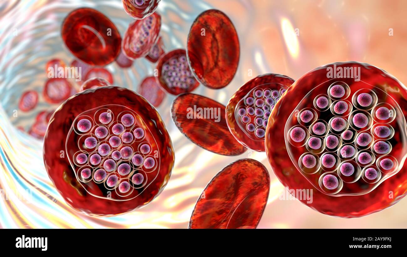 Plasmodium falciparum inside red blood cell, illustration Stock Photo ...