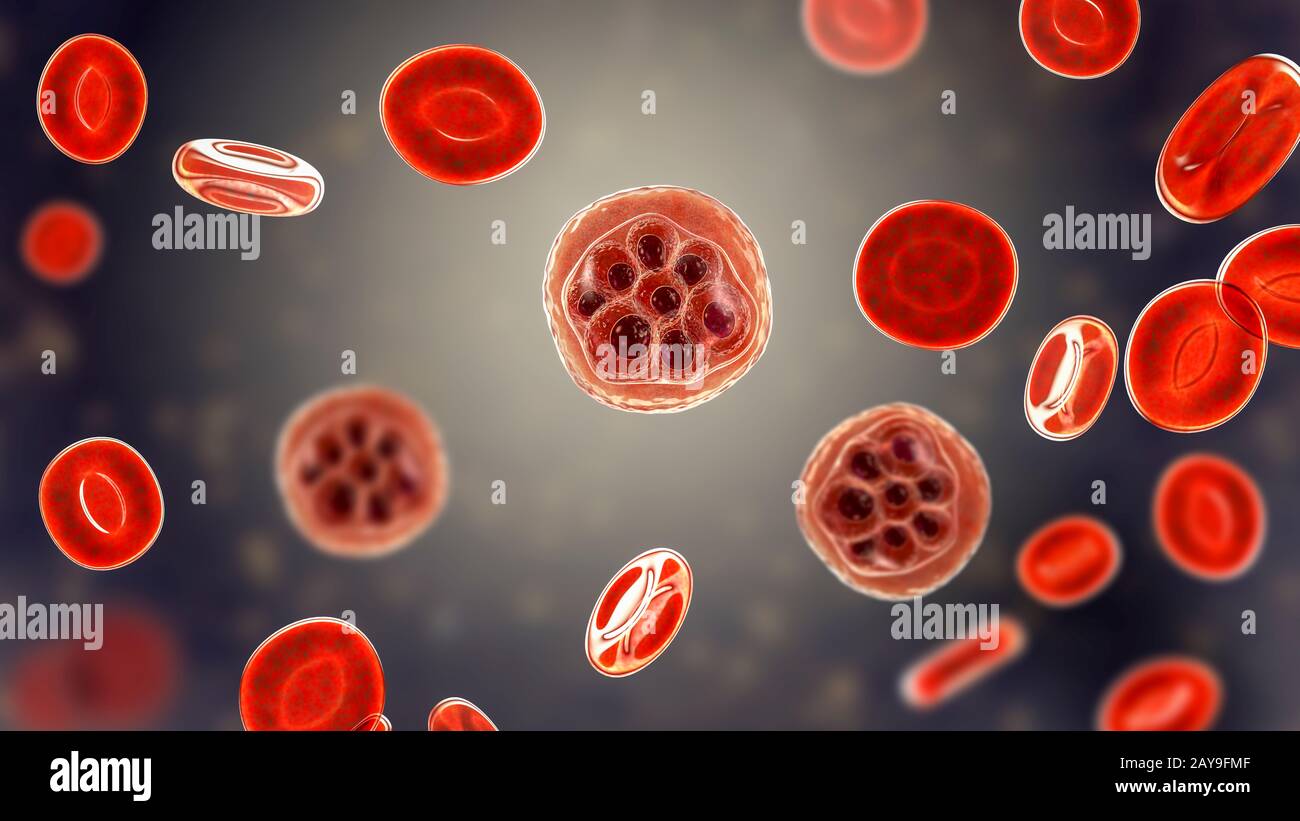 Malaria infection, illustration Stock Photo - Alamy