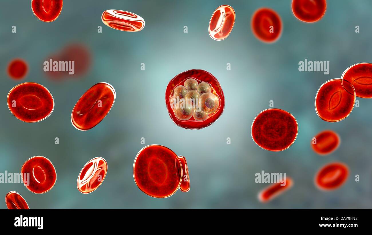 Malaria infection, illustration Stock Photo - Alamy