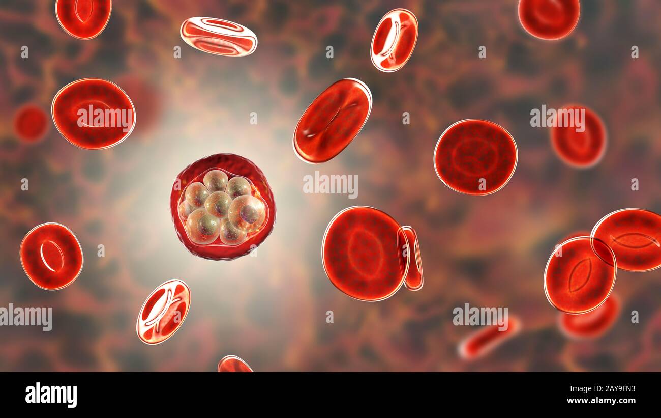 Malaria infection, illustration Stock Photo - Alamy