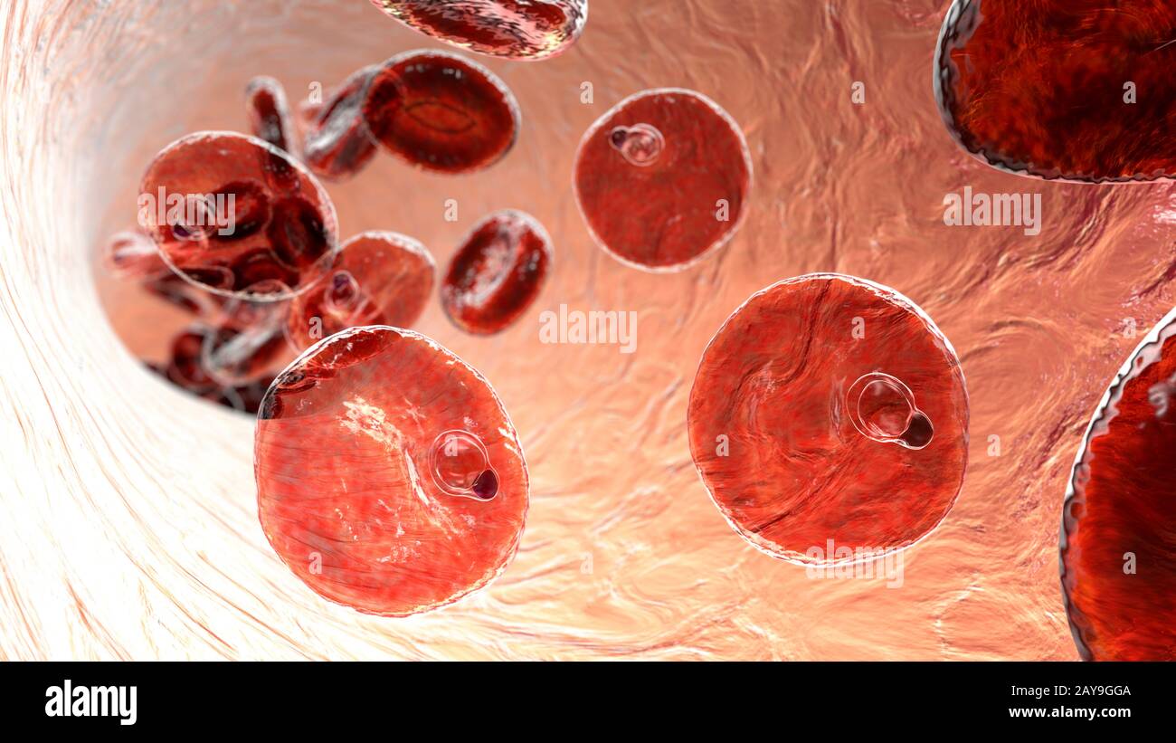 Plasmodium malariae inside red blood cell, illustration Stock Photo - Alamy
