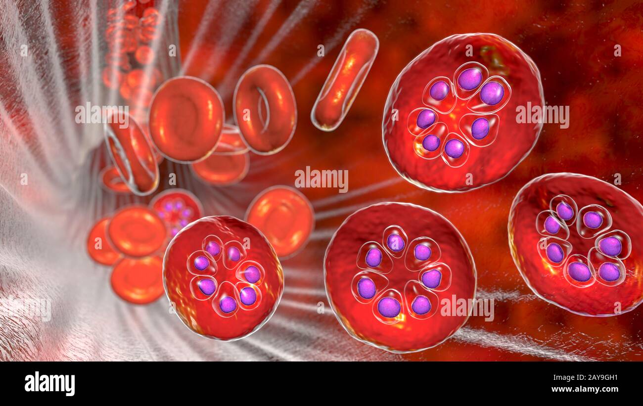 Plasmodium malariae inside red blood cell, illustration Stock Photo - Alamy