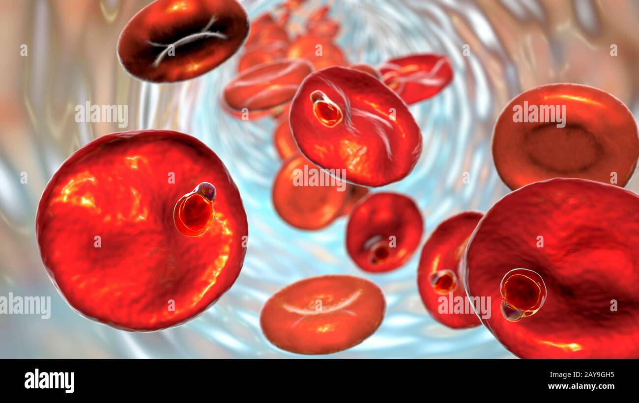 Plasmodium malariae inside red blood cell, illustration Stock Photo - Alamy