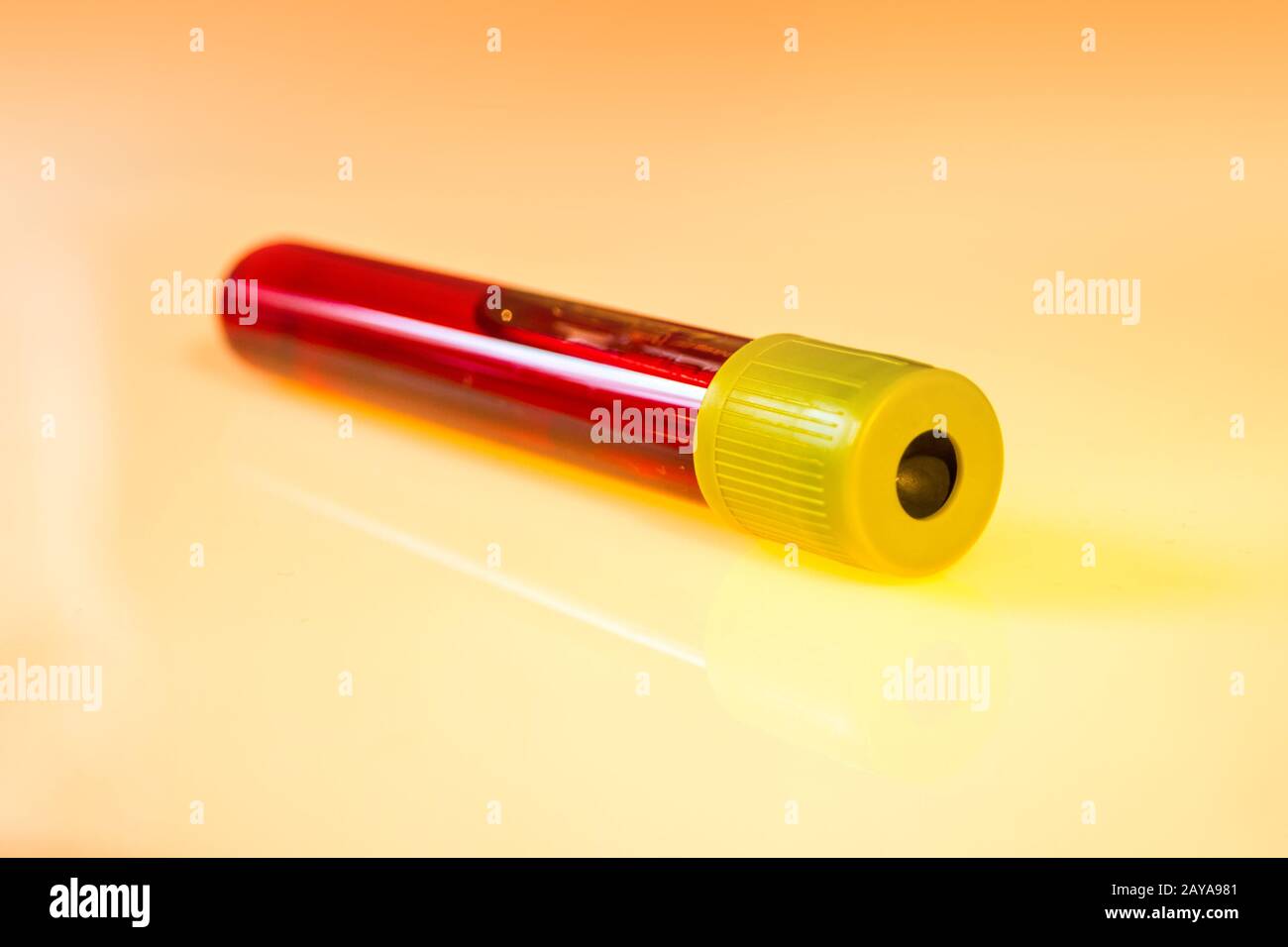 Blood test tube Stock Photo - Alamy