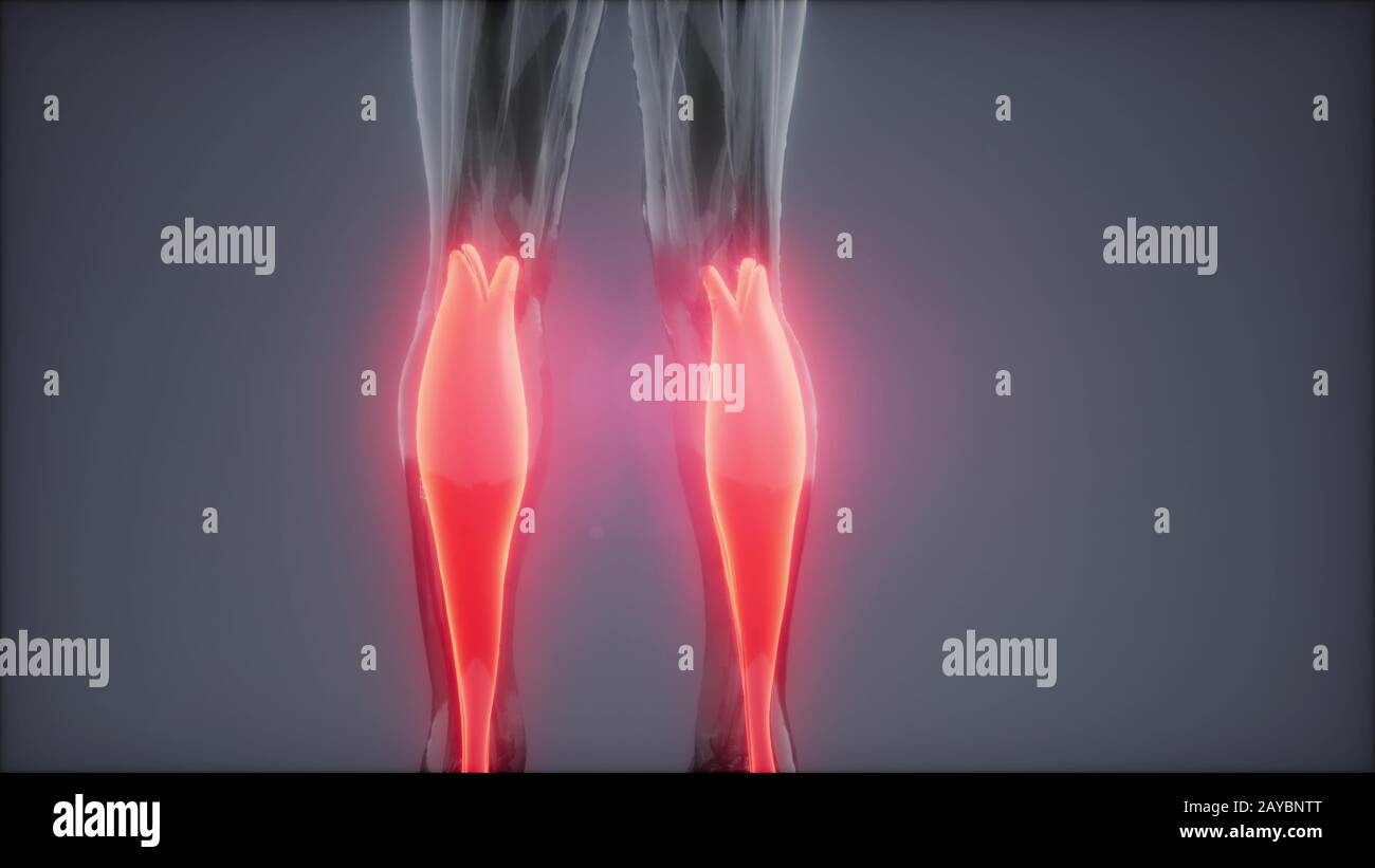 gastrocnemius- Visible muscle anatomy map Stock Photo - Alamy