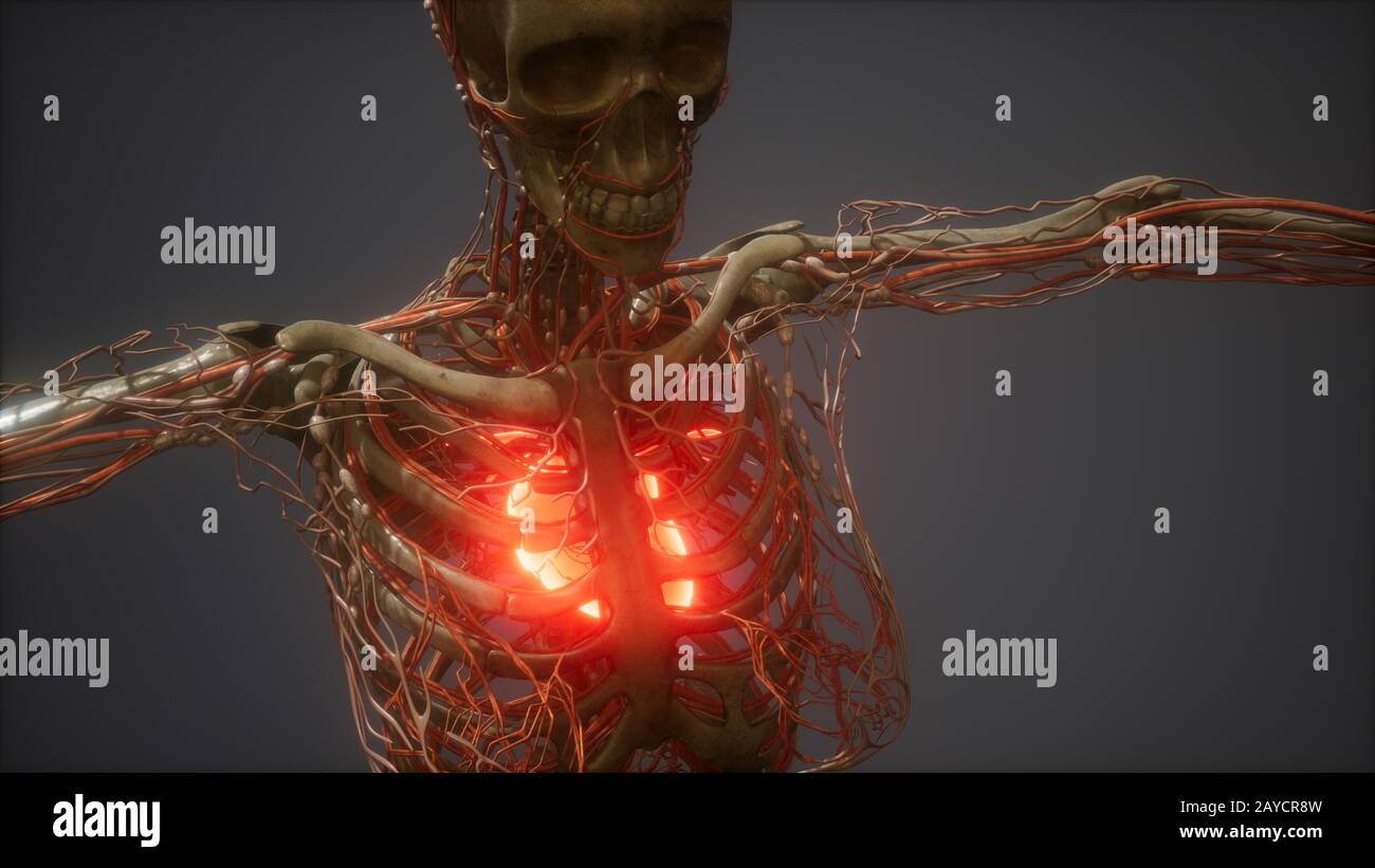 CG Animation Of A Sick Human Heart Stock Photo - Alamy