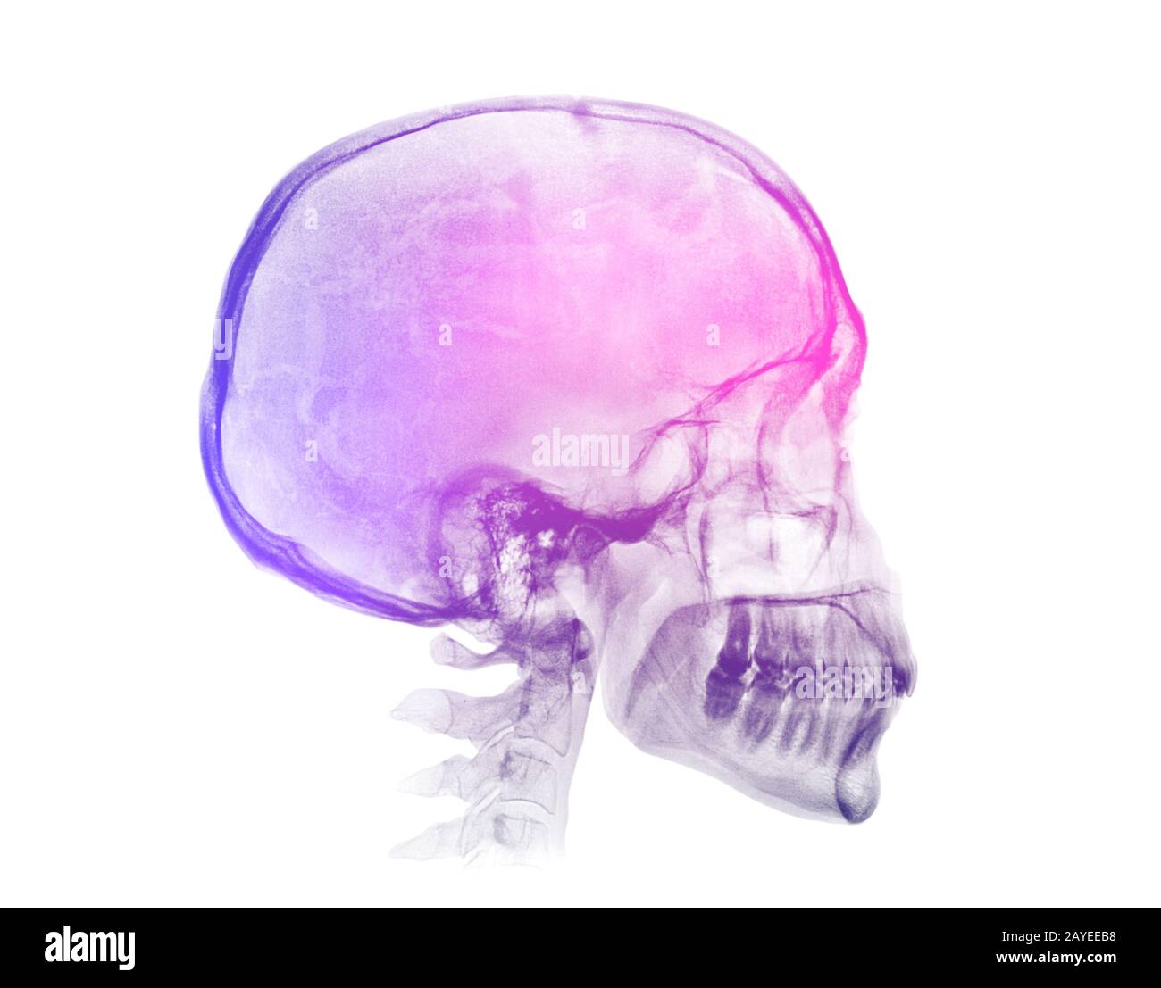 Human skull X-ray image Stock Photo - Alamy