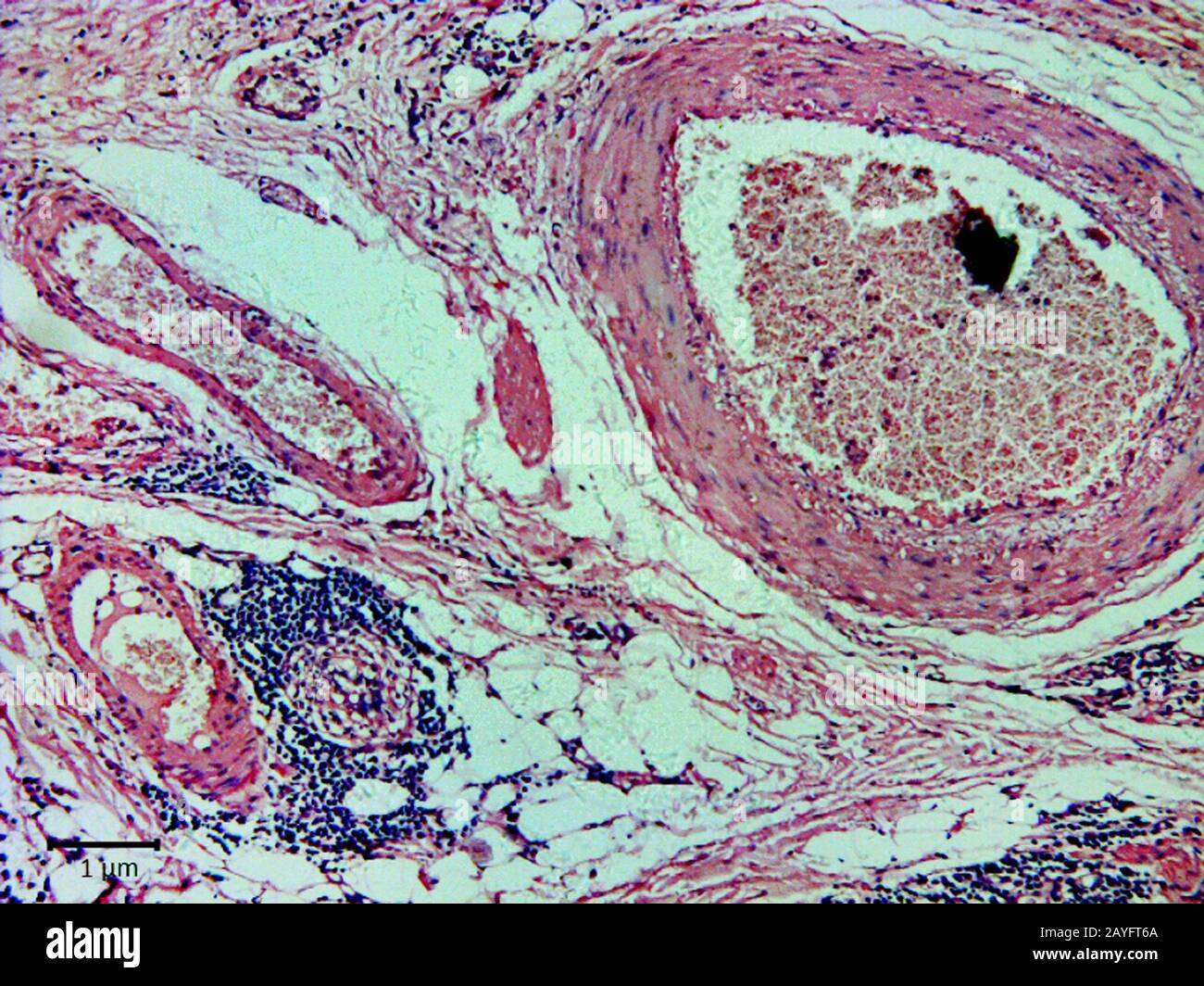 Stomach cancer horizontal hi-res stock photography and images - Alamy