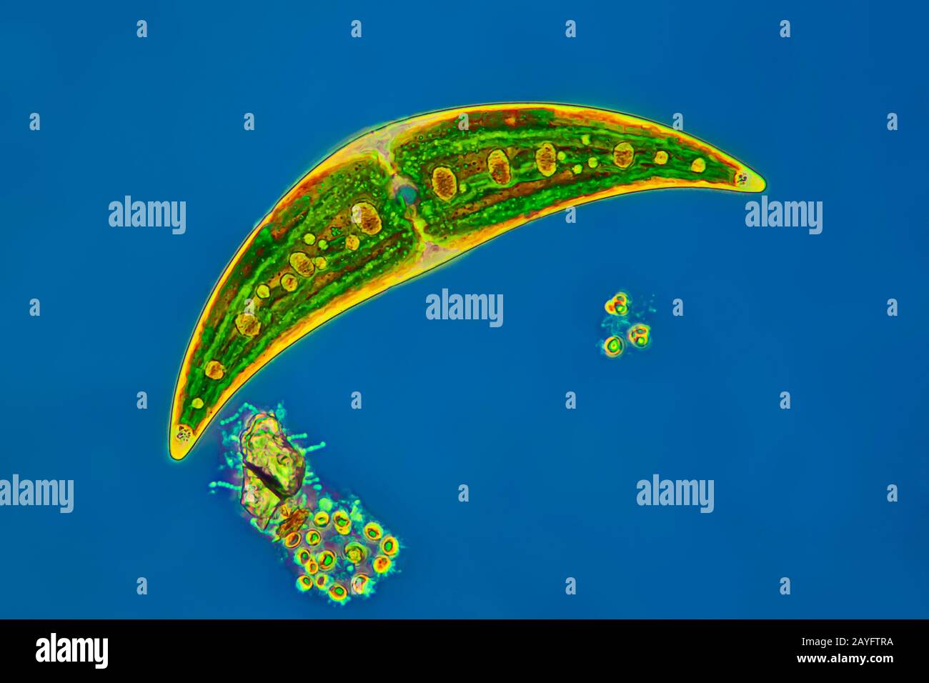 Closterium (Closterium spec.), as interphako picture, x 140, 10 cm ...