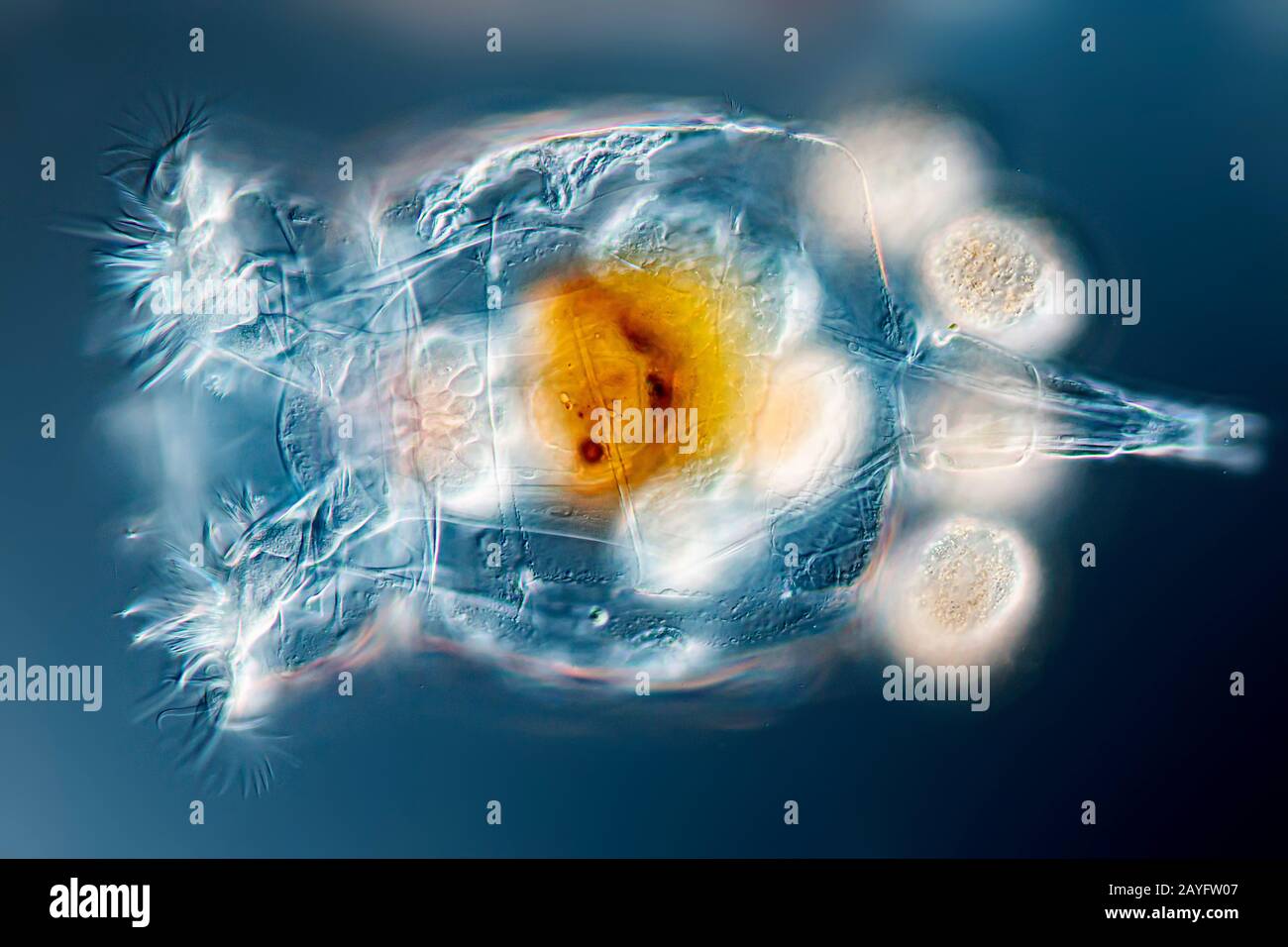 rotifer (Brachionus spec.), with uearthenogenetic eggs, DIK picture ...