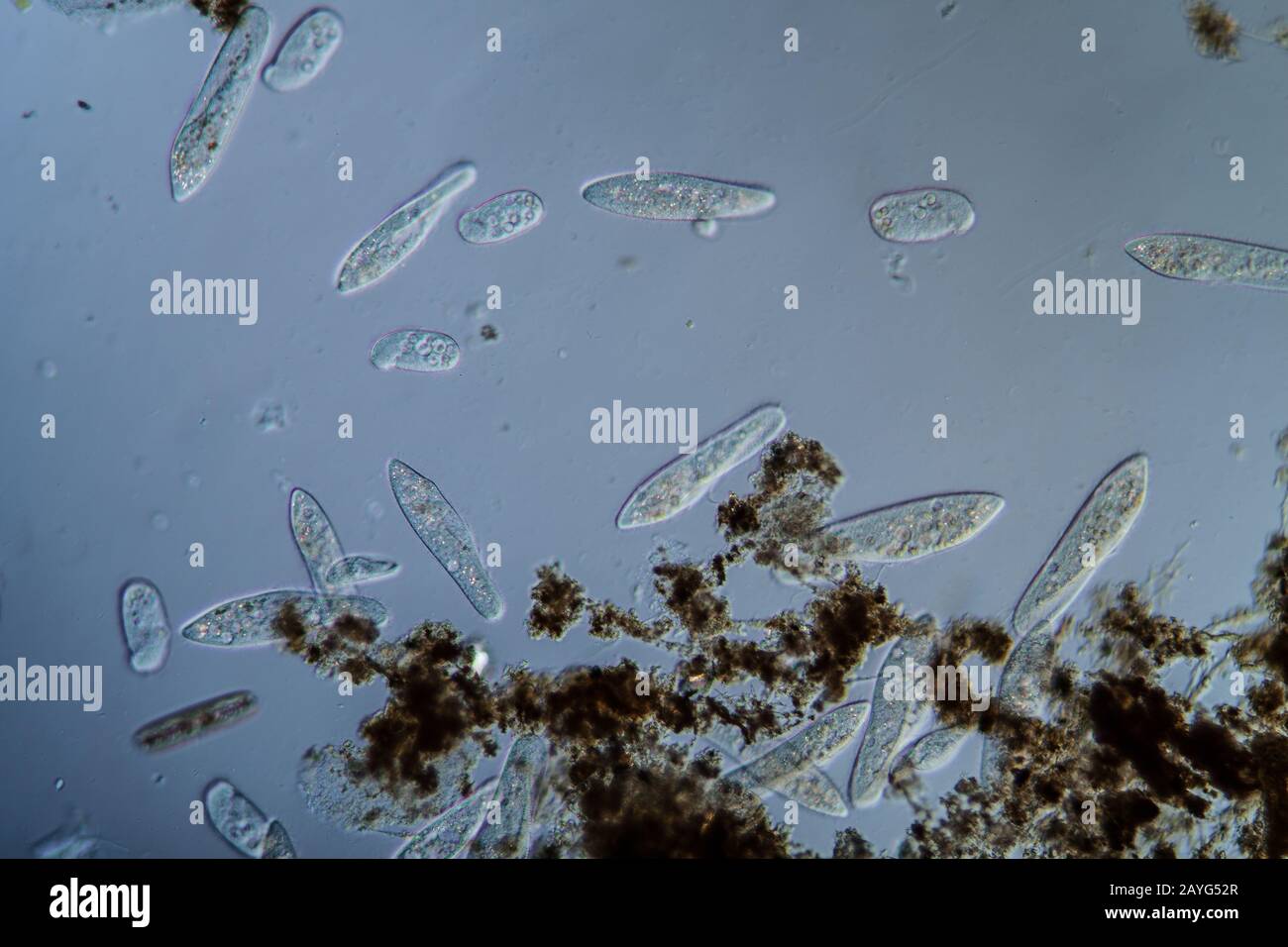 Plankton with microscopic ciliates Stock Photo - Alamy