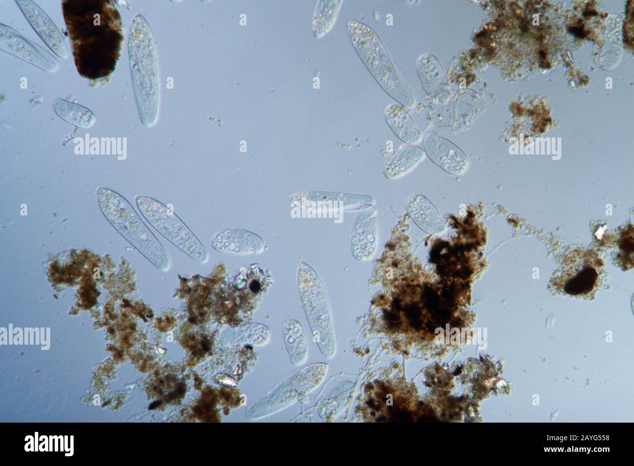 Plankton with microscopic ciliates Stock Photo - Alamy