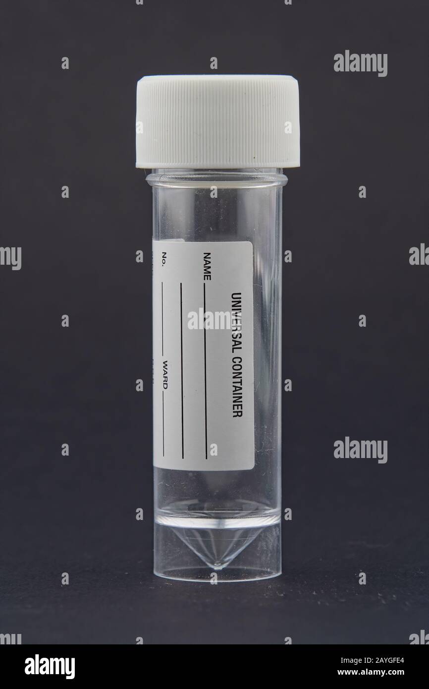 clear plastic specimen container with a white lid on a black background ...