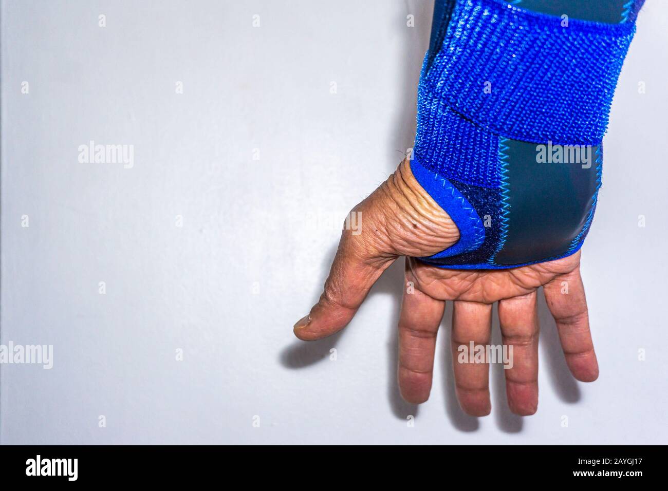 Wrist fracture hi-res stock photography and images - Alamy