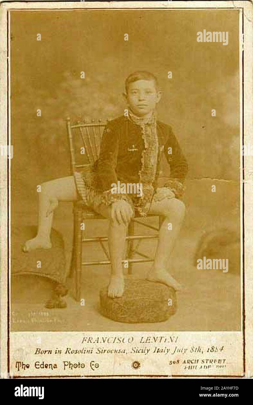 Frank lentini hi-res stock photography and images - Alamy